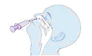 Nasal Wash and Swab Collection | University of Colorado Hospital